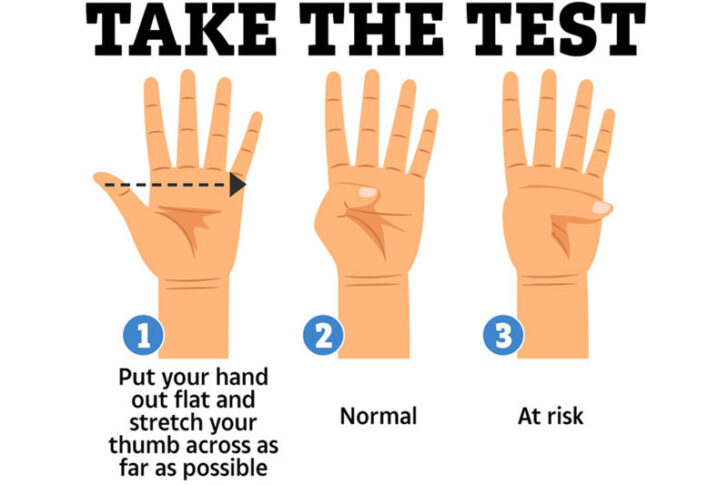 Simple Thumb Test Could Indicate The Likelihood You’re Harboring An ...